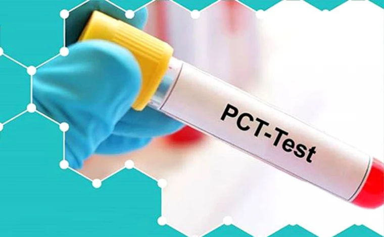 تست PCT چیست ️+ روش انجام و تفسیر آن - رادینا سلامت